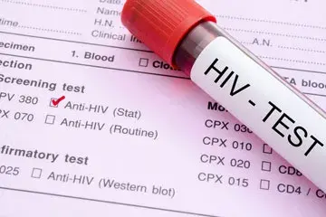 Coding for HIV and AIDS in ICD-10 - Important Clarifications