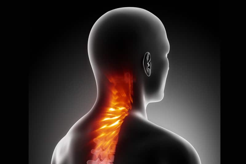Coding Cervical Myelopathy Cervical Spine Degenerative Disorder Coding Cervical Myelopathy Cervical Spine Degenerative Disorder