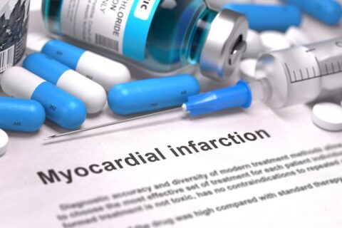 Diagnostic Coding Rules For Myocardial Infarction