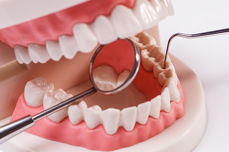 Bone Graft Icd 10