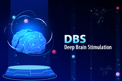 Learn about the Medical Codes for DBS